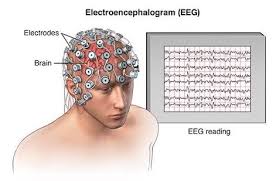 How Much Does an EEG Machine Cost in 2025?